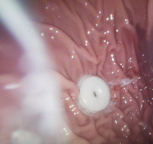 Advanced Practical Endoscopy - CPD Solutions Online Shop